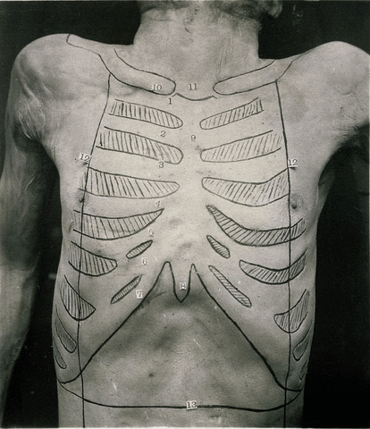 Rib Cage GIFs - Get the best GIF on GIPHY