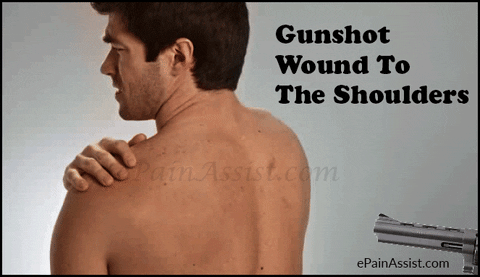 Gunshot-wound-to-the-shoulders GIFs - Get the best GIF on GIPHY