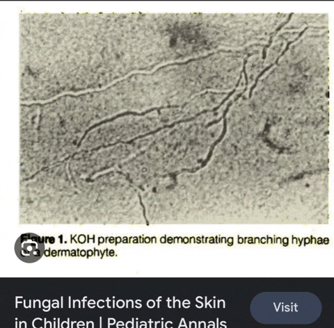 Fungal skin scraping, KOH Prep, 250x mag, positive or negative? Thanks ...