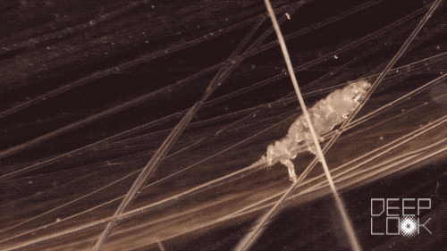 Head-louse GIFs - Get the best GIF on GIPHY