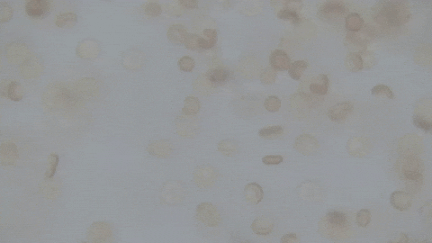 Transfusion Medicine GIFs on GIPHY - Be Animated