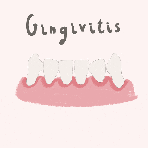 Gingivitis GIFs - Get the best GIF on GIPHY