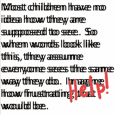 Vision Therapy GIFs on GIPHY - Be Animated