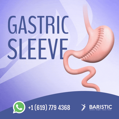 Gastric-sleeve GIFs - Get the best GIF on GIPHY