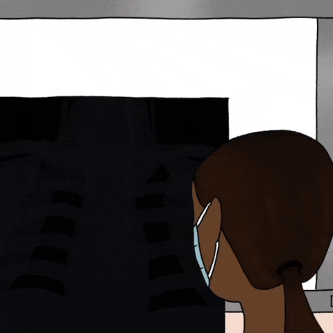 Xray Bones Metal Implant Alien GIFs - Get the best GIF on GIPHY