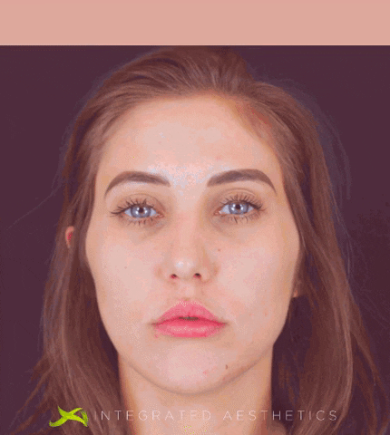 Tear Trough GIFs - Get the best GIF on GIPHY