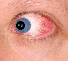 One Eye GIFs - Get the best GIF on GIPHY