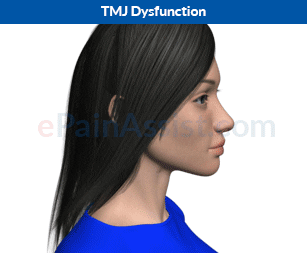 Temporomandibular Joint Disorder GIFs - Get the best GIF on GIPHY